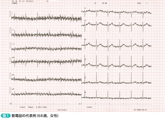 振幅・周波数ともに不規則で小さなノイズ波形